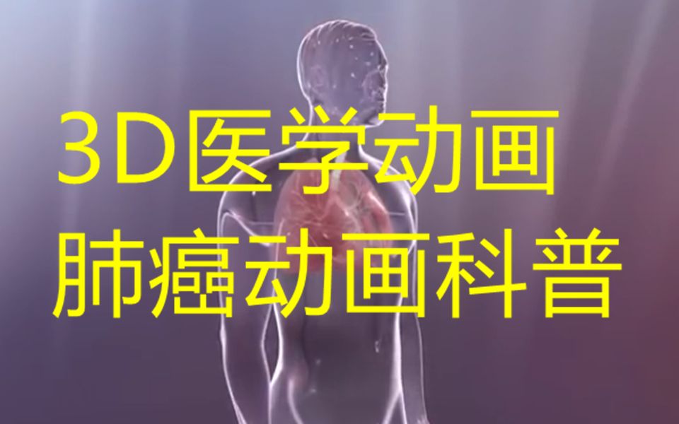 肺癌动画科普-3D动画科普