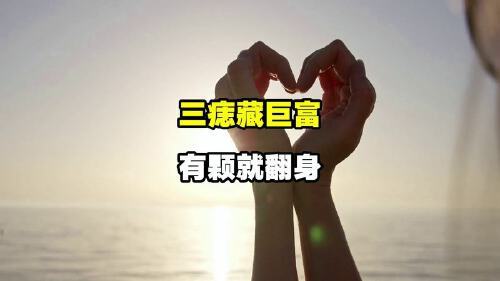 三颗痣定你一生财运,这个位置有痣注定大富大贵!