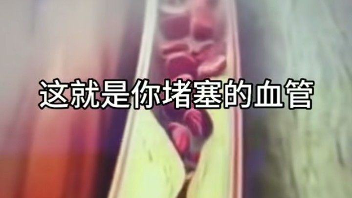 这是你堵塞的血管!如何疏通?