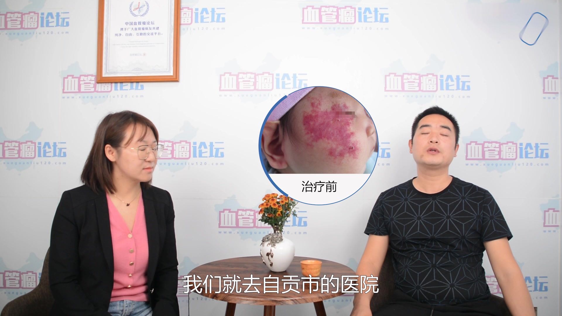面部混合型血管瘤 罗#予《中国血管瘤论坛》患友分享
