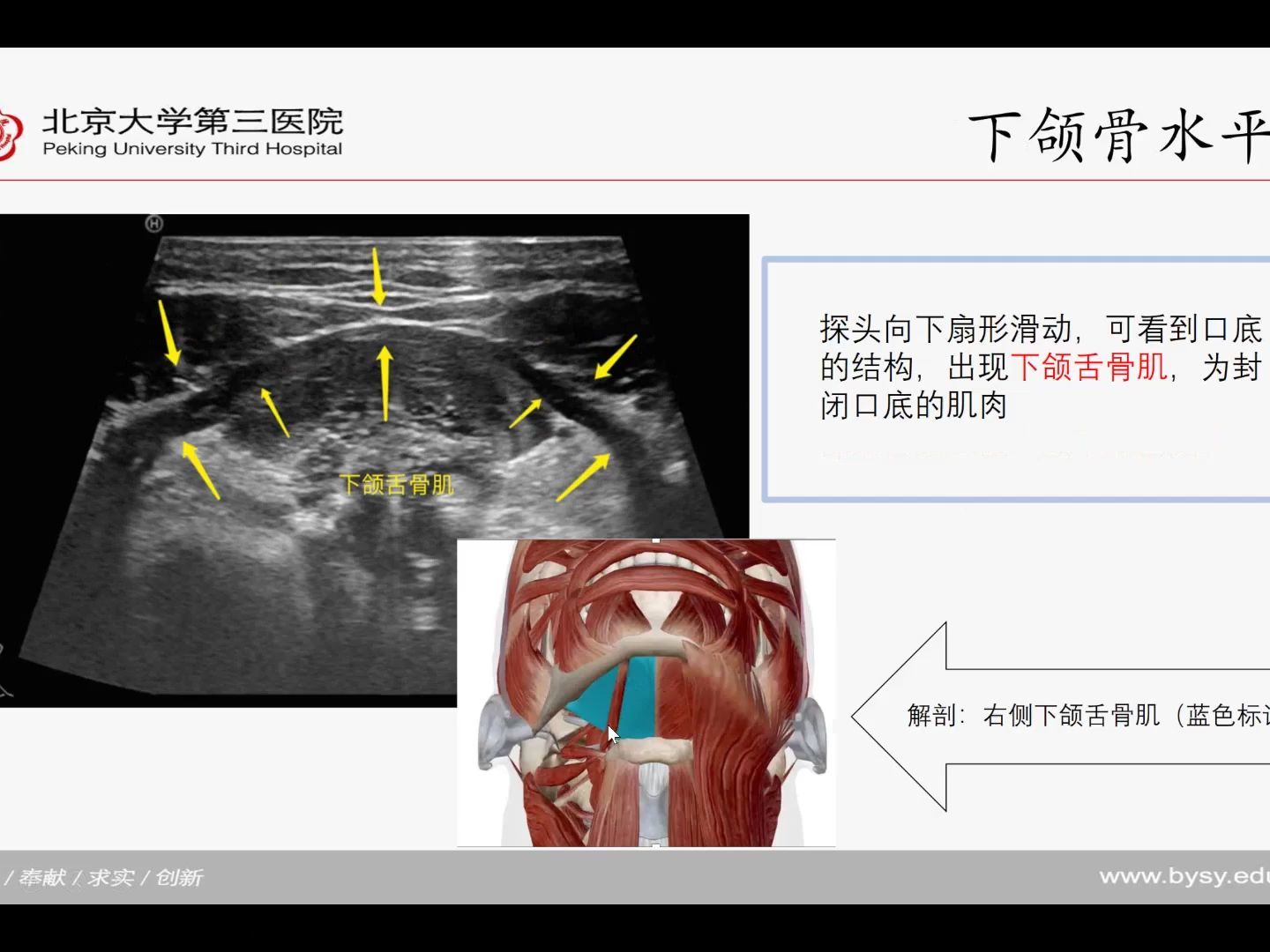口底、咽喉区超声解剖与临床应用,北医三院,崔立刚