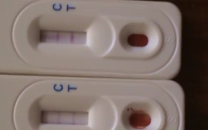 外国小哥用试纸快速检测HIV