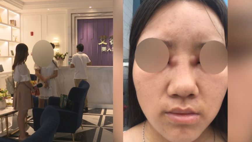 做隆鼻手术,鼻子被开了四刀,留下断层后,连医生名字都不知道?