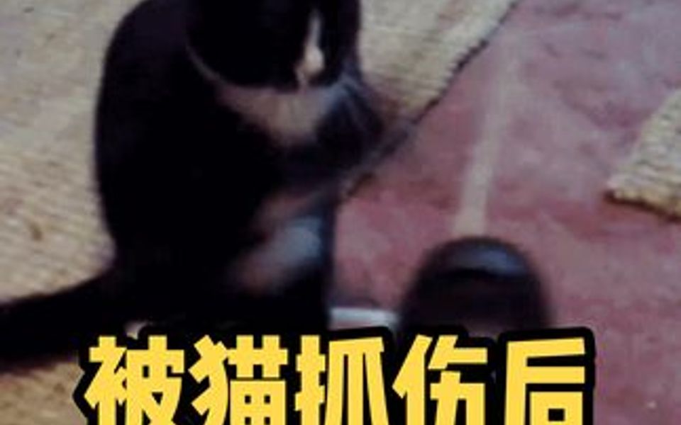 被猫抓伤后要不要打狂犬疫苗?建议牢记世界卫生组织的建议~