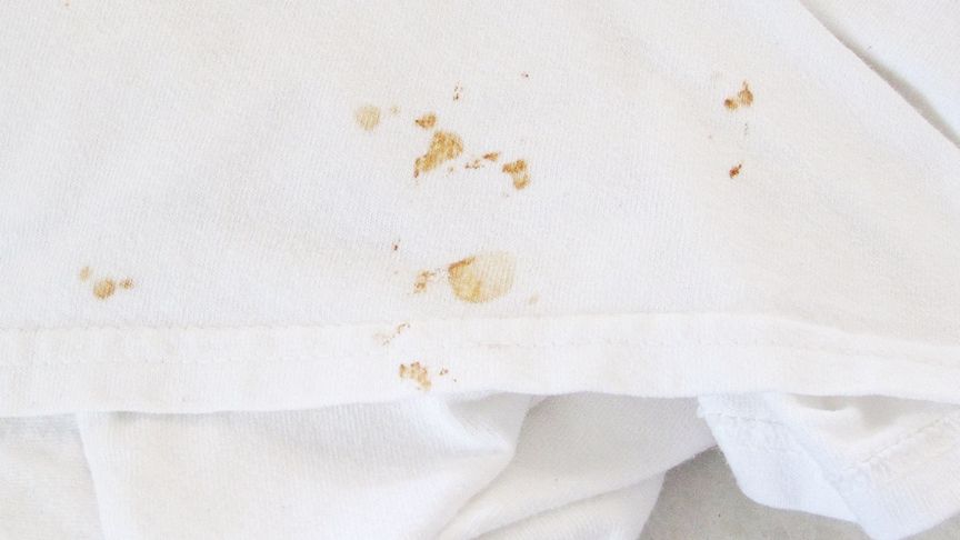 衣服上有血渍怎么办?其实很容易就能去除,只是你的方法不对