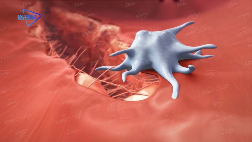 3D还原:凝血过程