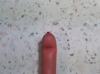 如何进行包皮环切术