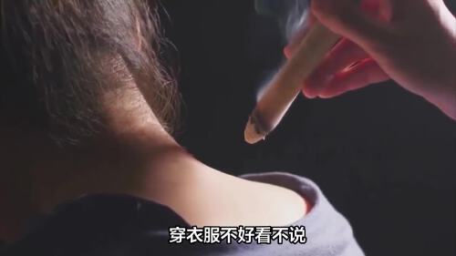 躺着瘦腰!揭秘艾灸减肚子的神奇真相