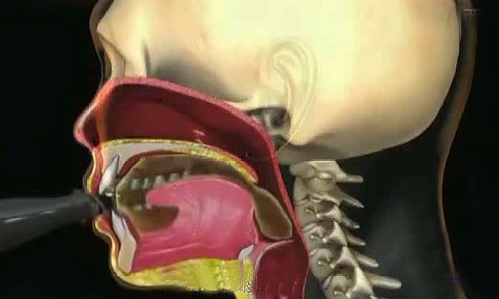 一个动画让你明白,酒精是怎样在人体内代谢的,看完后你还喝吗?