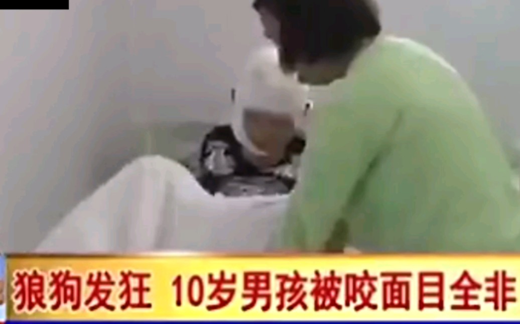 狗狗作为“人类最忠诚的朋友”就是喜欢撕咬10岁的小男孩小女孩!...