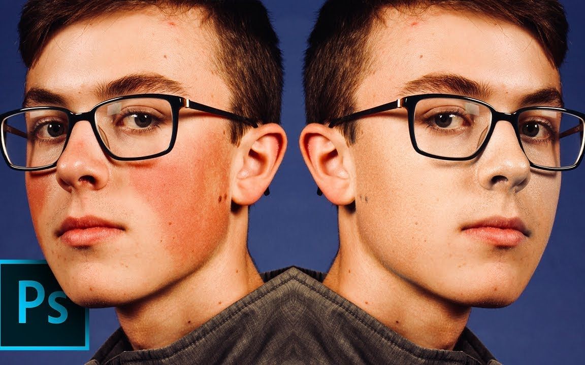 【PS小技巧】一分钟教你用PS去除脸上的红斑!