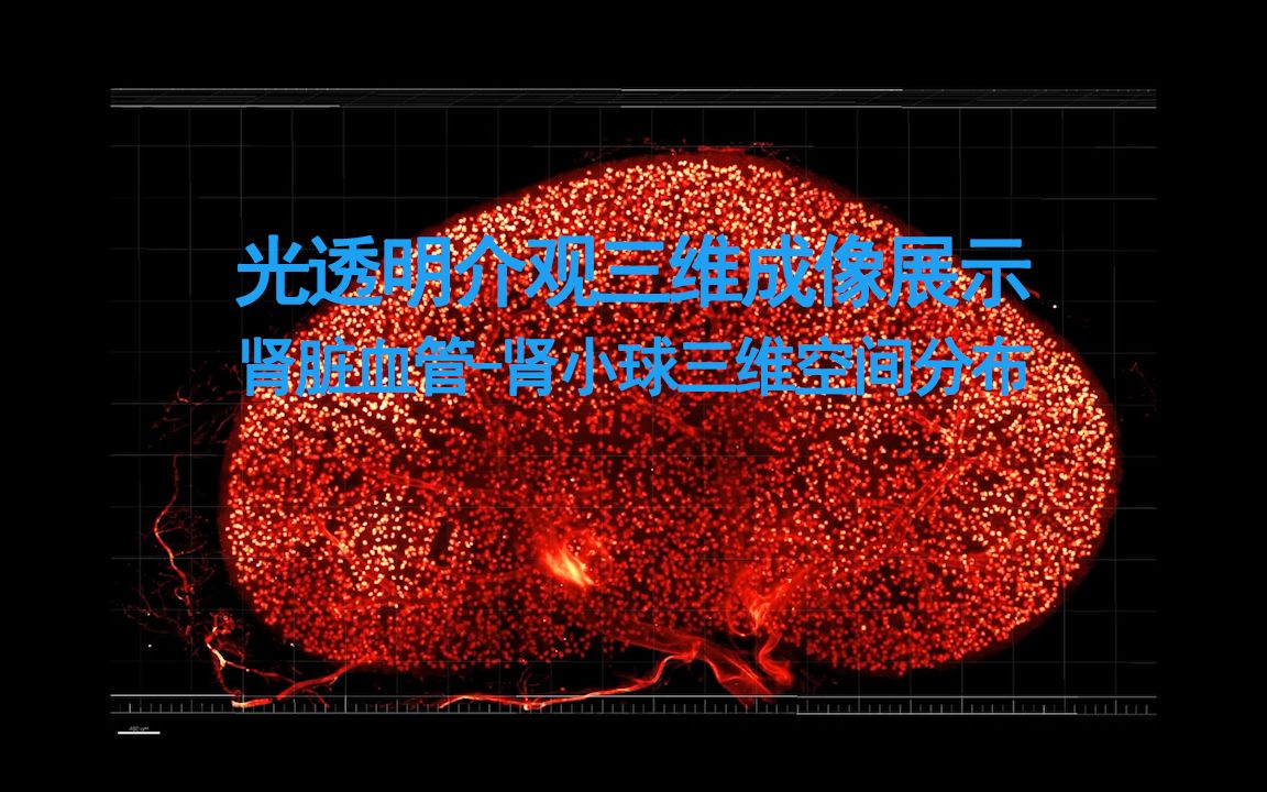 光透明介观三维成像展示——肾脏血管-肾小球三维空间分布