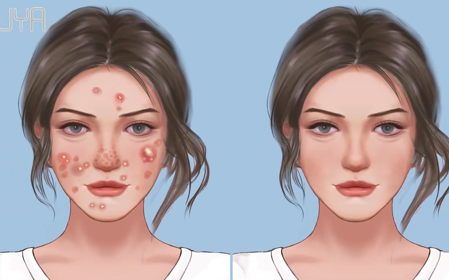 【沉浸式护理】去眼石,祛痘护肤动画