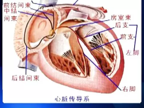 手术现场直击——心脏起搏器植入术