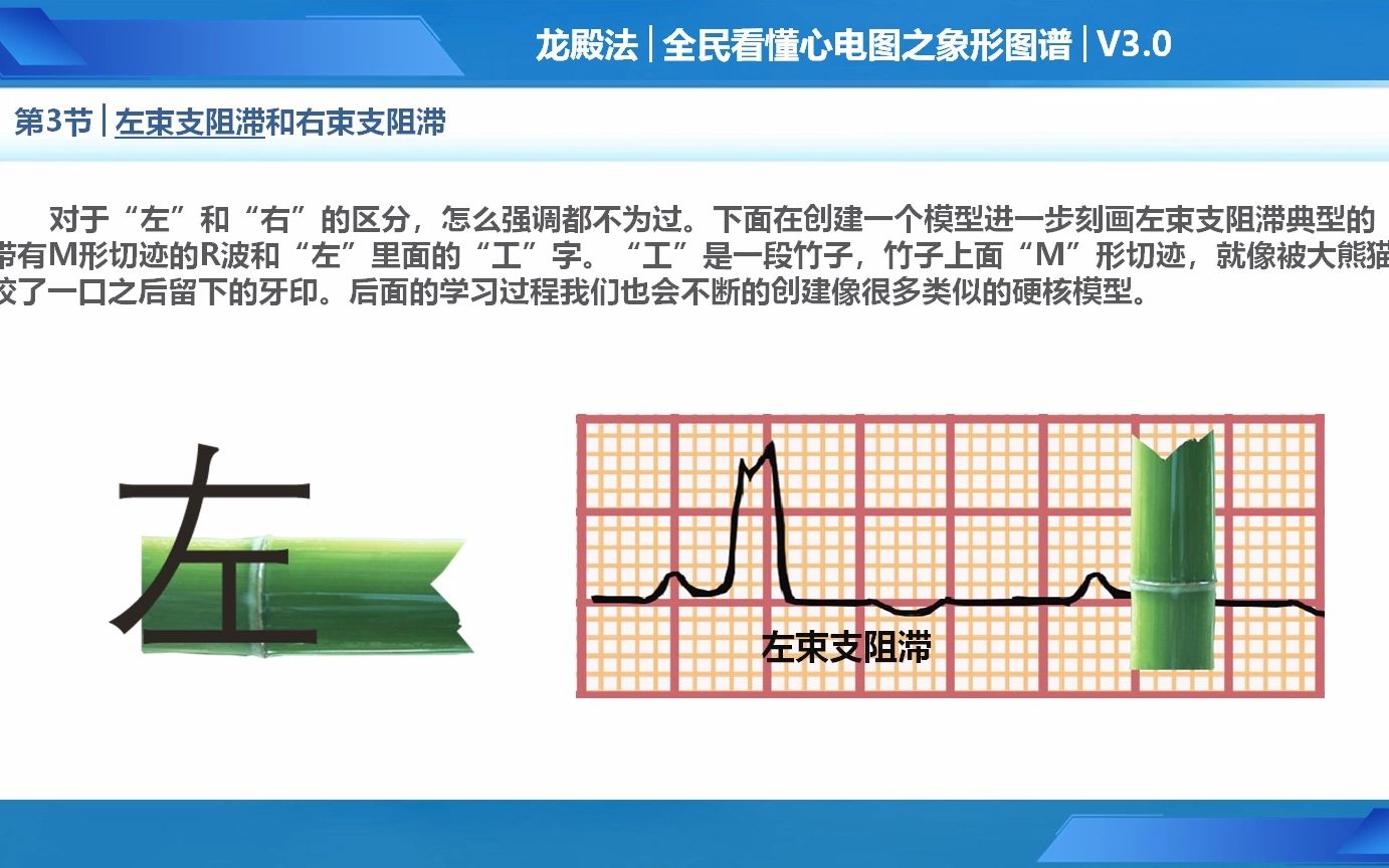 [15.03]左束支阻滞和右束支阻滞【龙殿法全民看懂心电图】助理执业...