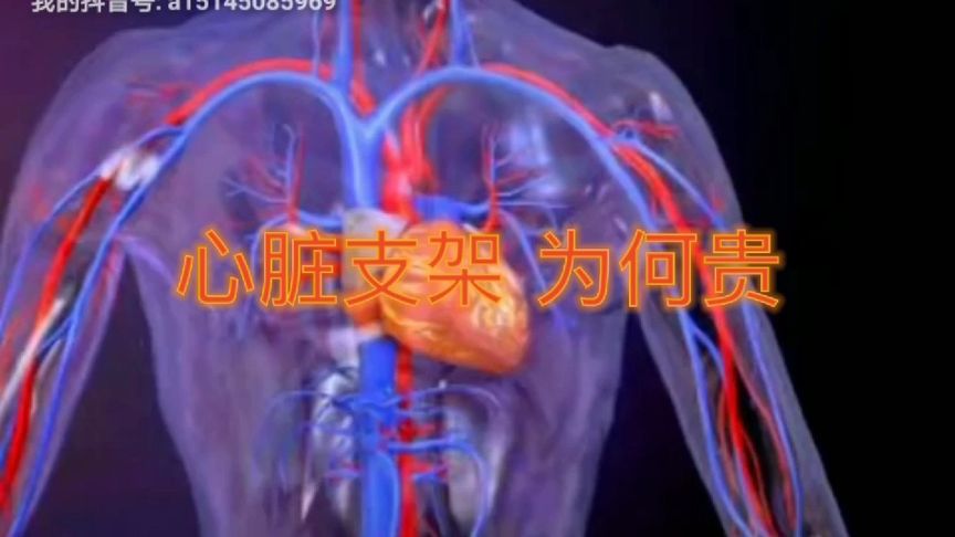 动画演示心脏支架