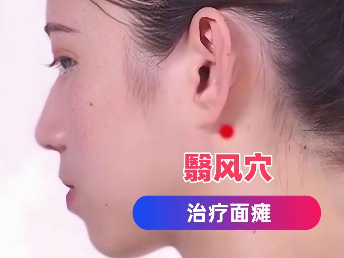 165、手少阳三焦经 — 翳风穴 — 治疗面瘫