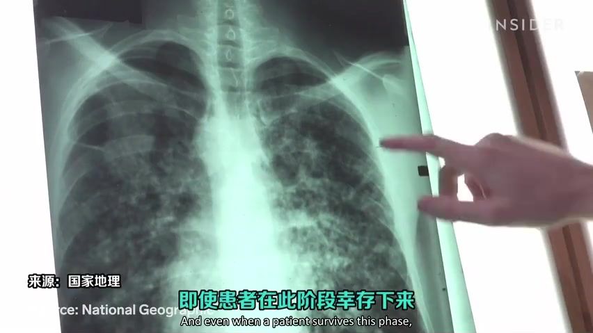 大数据分析:感染新冠病毒后,身体会发生什么变化?