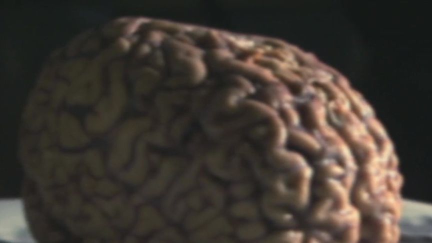 科学1:为让计算机能模拟人类的大脑,他们这样做丨人体奇迹1220