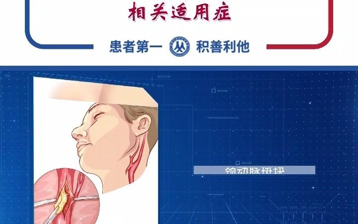 川蜀血管病医院-三氧大自血疗法相关适用症