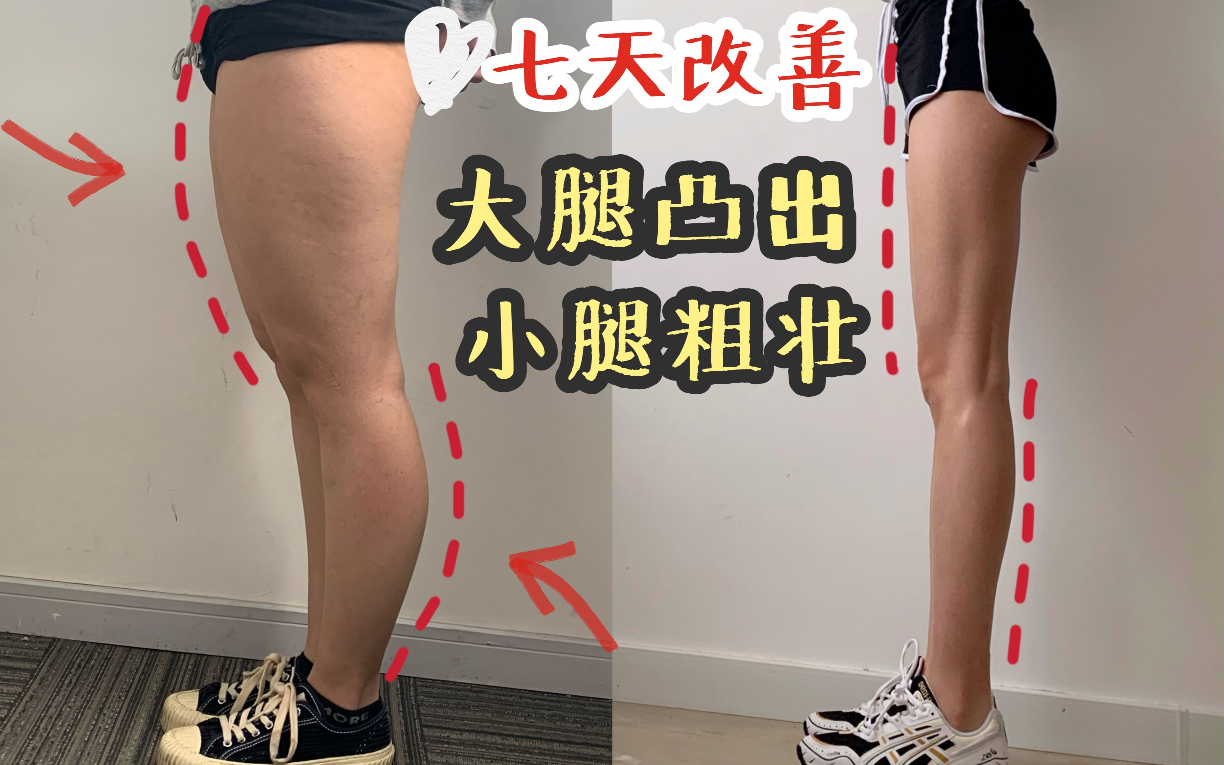 大腿前侧粗壮凸出小腿肚向后突出腿形不直必练一周见效的教程!