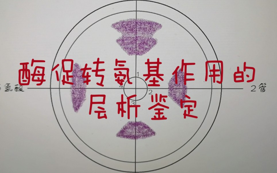【天青夏妖】谷丙转氨酶酶促转氨基作用的层析鉴定