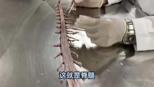 这就是脊髓,他是连接大脑和周围神经系统的关键,结构十分复杂