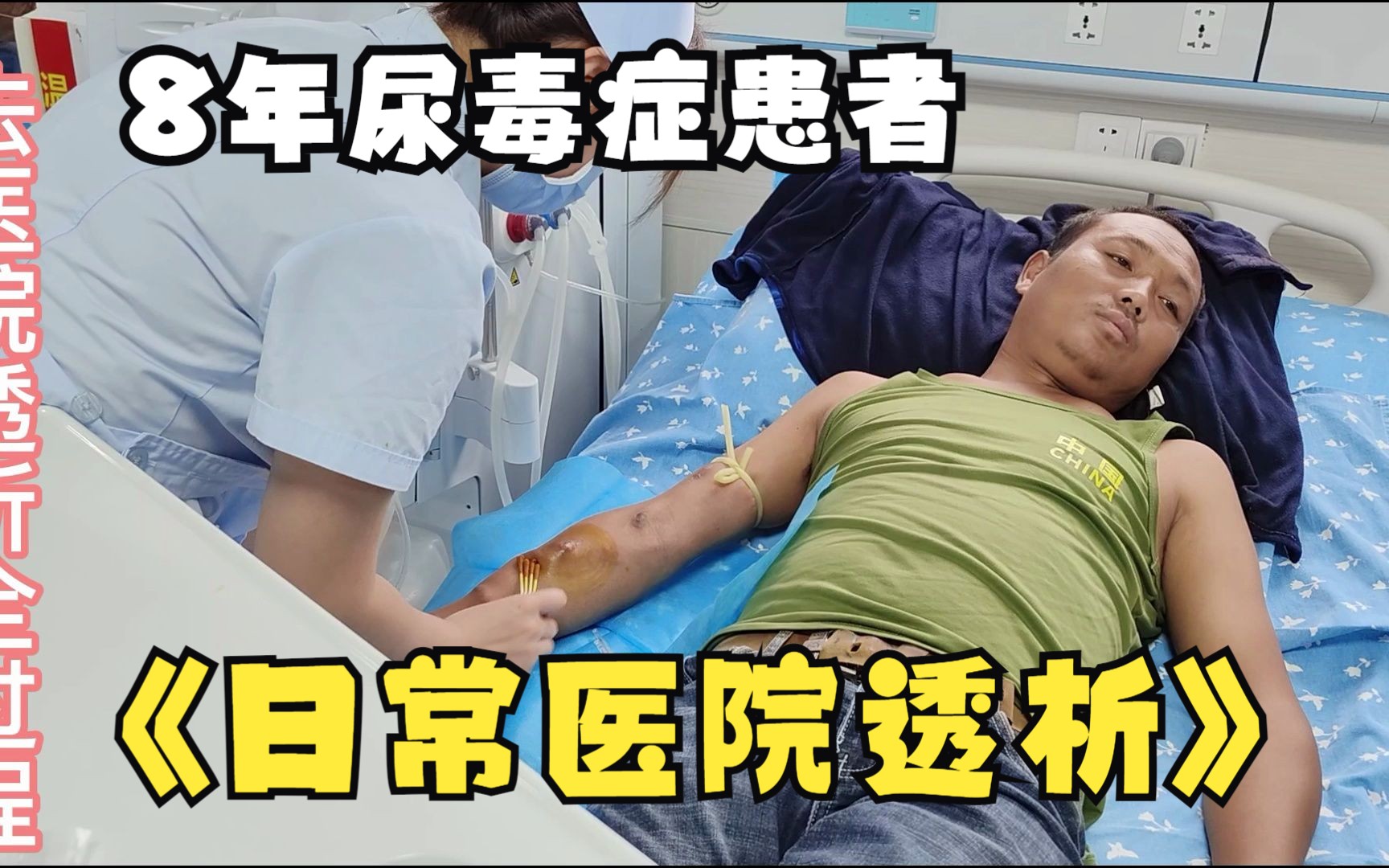 尿毒症患者医院透析全过程