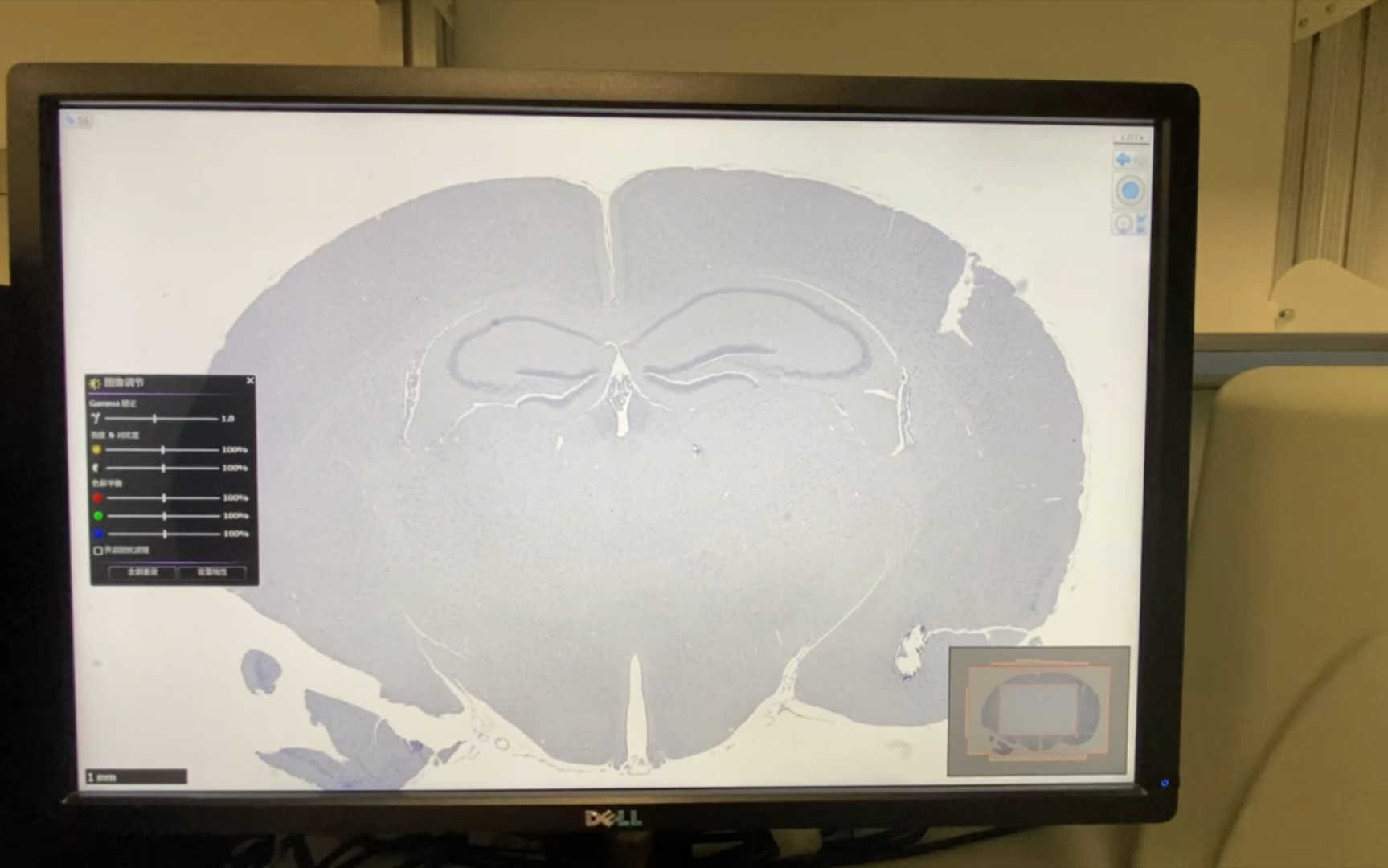 用数字切片成像仪扫描病理片子,远比显微镜方便简单～