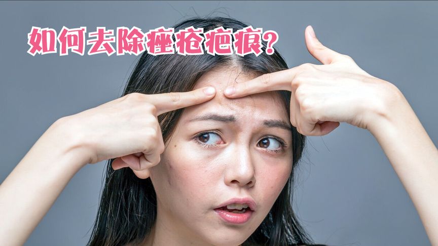 护肤课堂|如何去除痤疮疤痕?药师给出1方法,还你白净肌肤