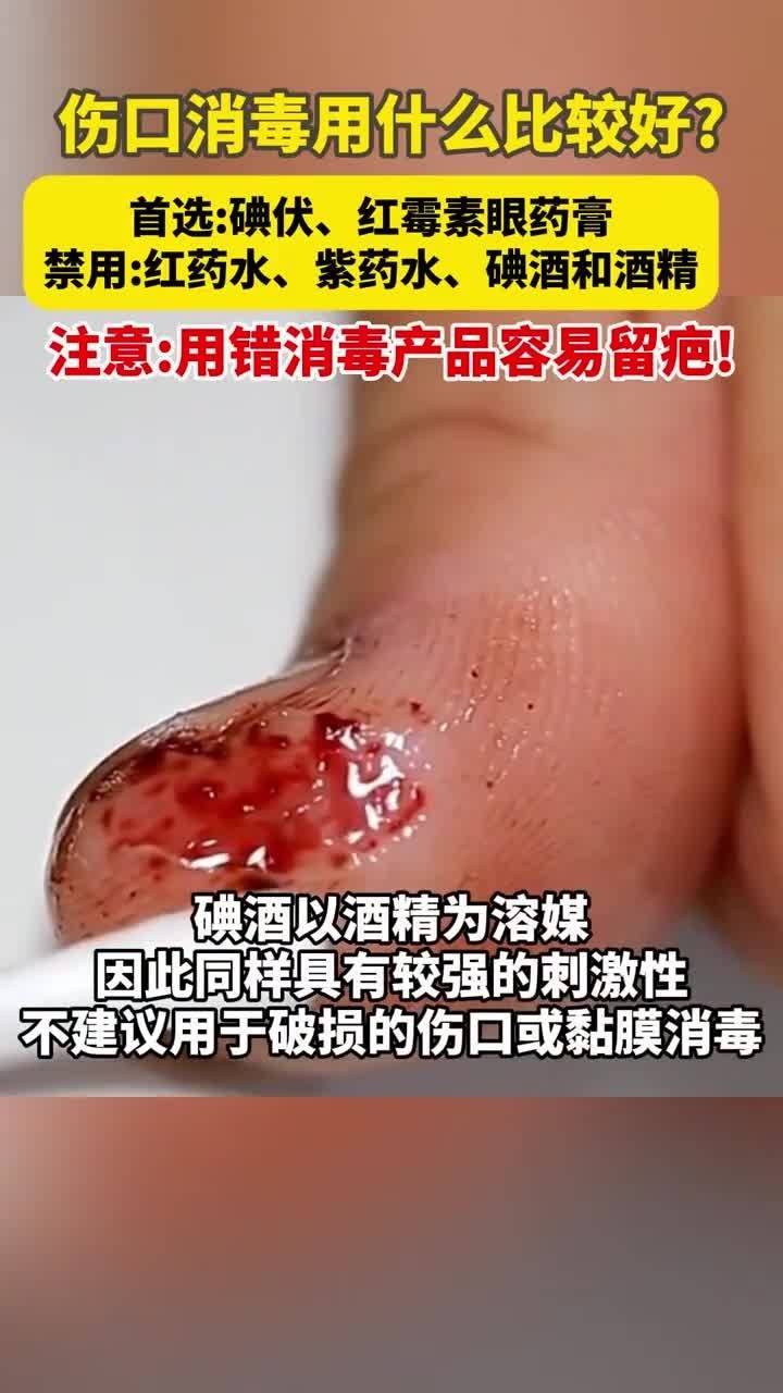 伤口消毒用什么比较好?注意:用错消毒产品容易留疤!
