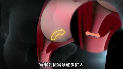 女性自然分娩的全过程,看完你会感叹母爱的伟大