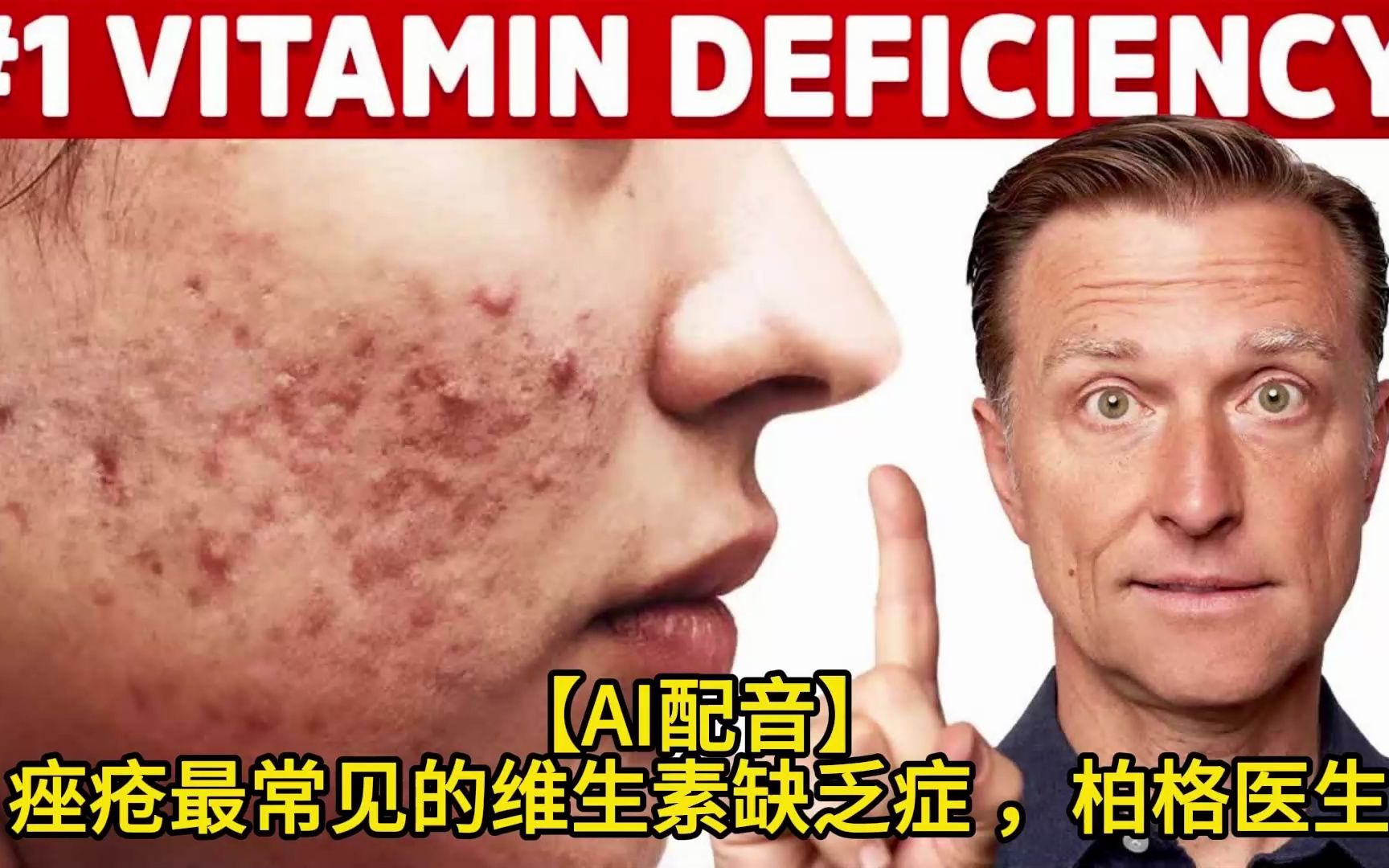 【AI配音】痤疮最常见的维生素缺乏症 ,柏格医生