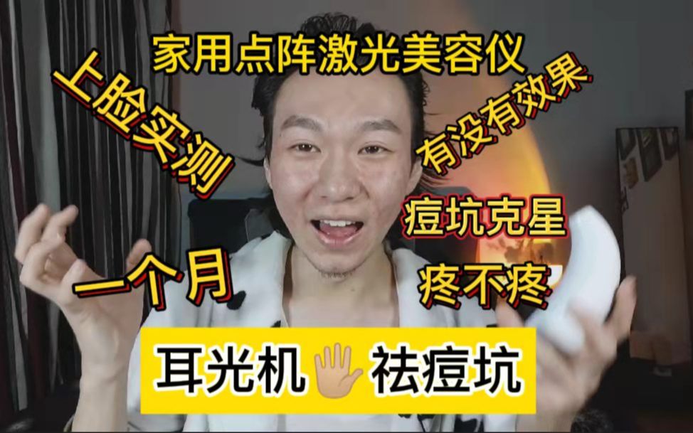 家用点阵激光美容仪❗祛痘坑ߌ�易美肌耳光机ߖ�ߏ�实测一月