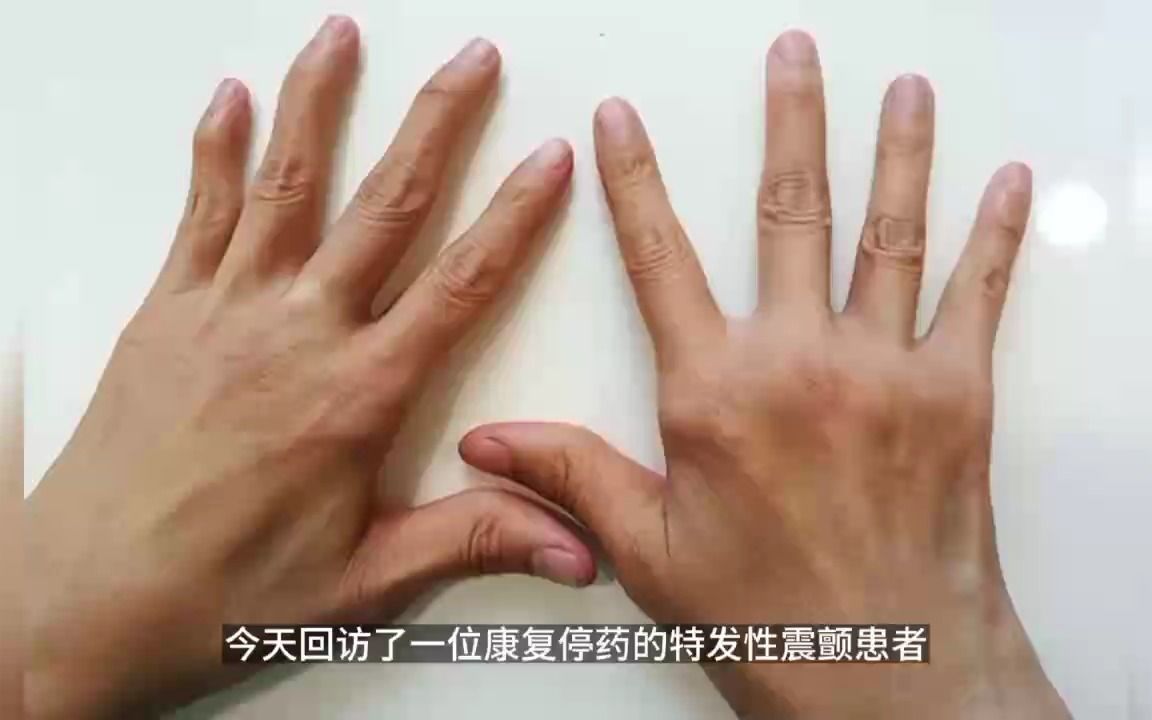 老年人不由自主手抖?尤其紧张时,伴有失眠,焦虑,心慌,一张方子搞定?