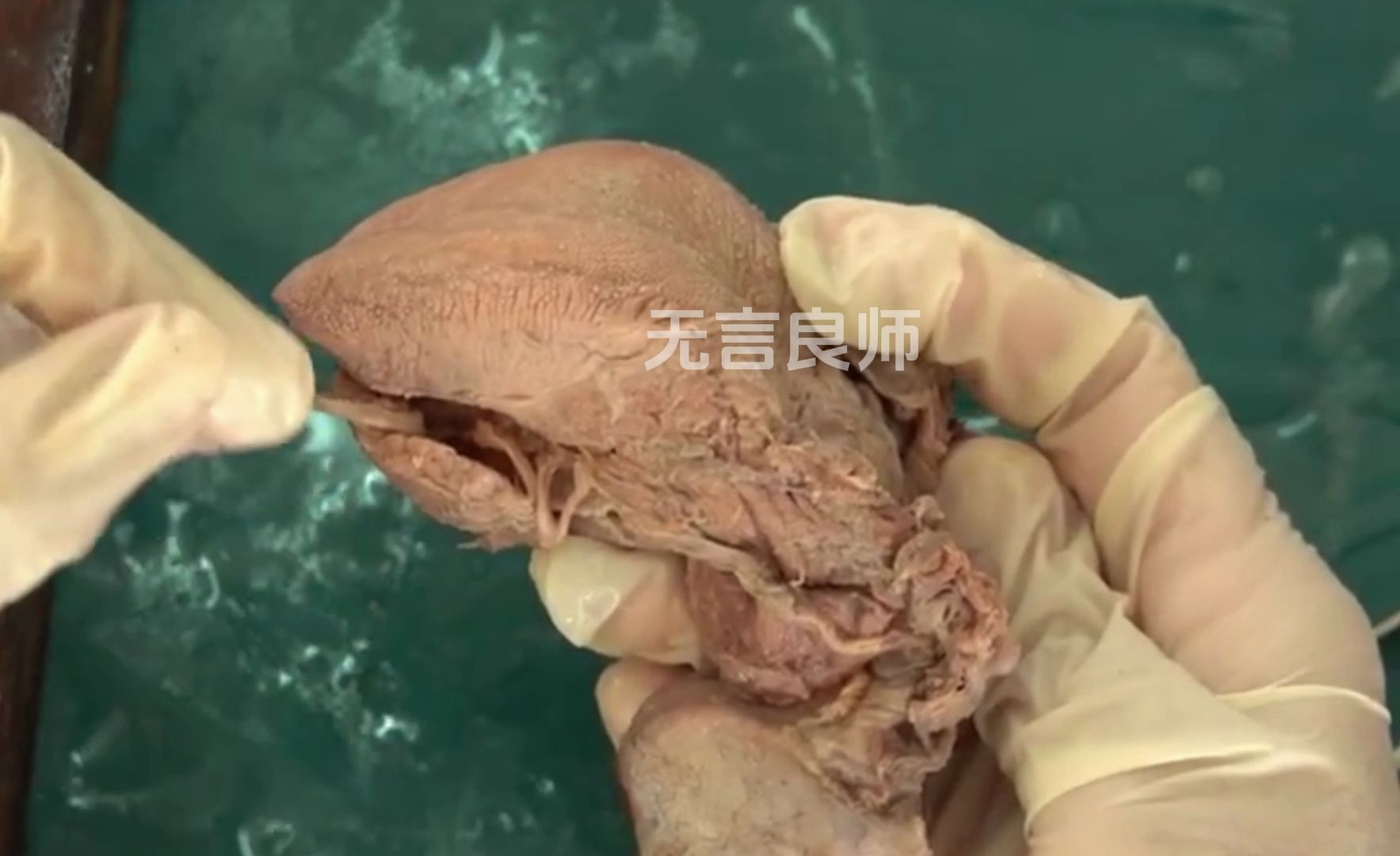 这是一段真实的人类喉部标本,当你在视频中看到喉部的开口处时,不难...