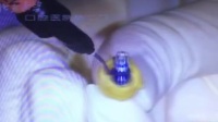 义乌鹏城口腔前牙美学修复取模小技巧视频(仅供口腔种植医生学习指导)