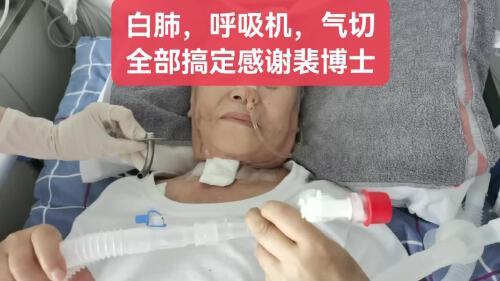 白肺,呼吸机脱机气,切封管,都搞定了。走回家!