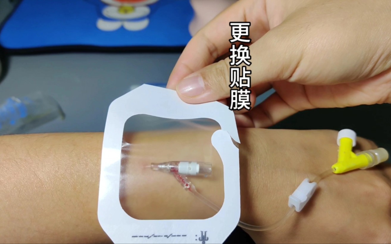 最后一集:更换留置针贴膜