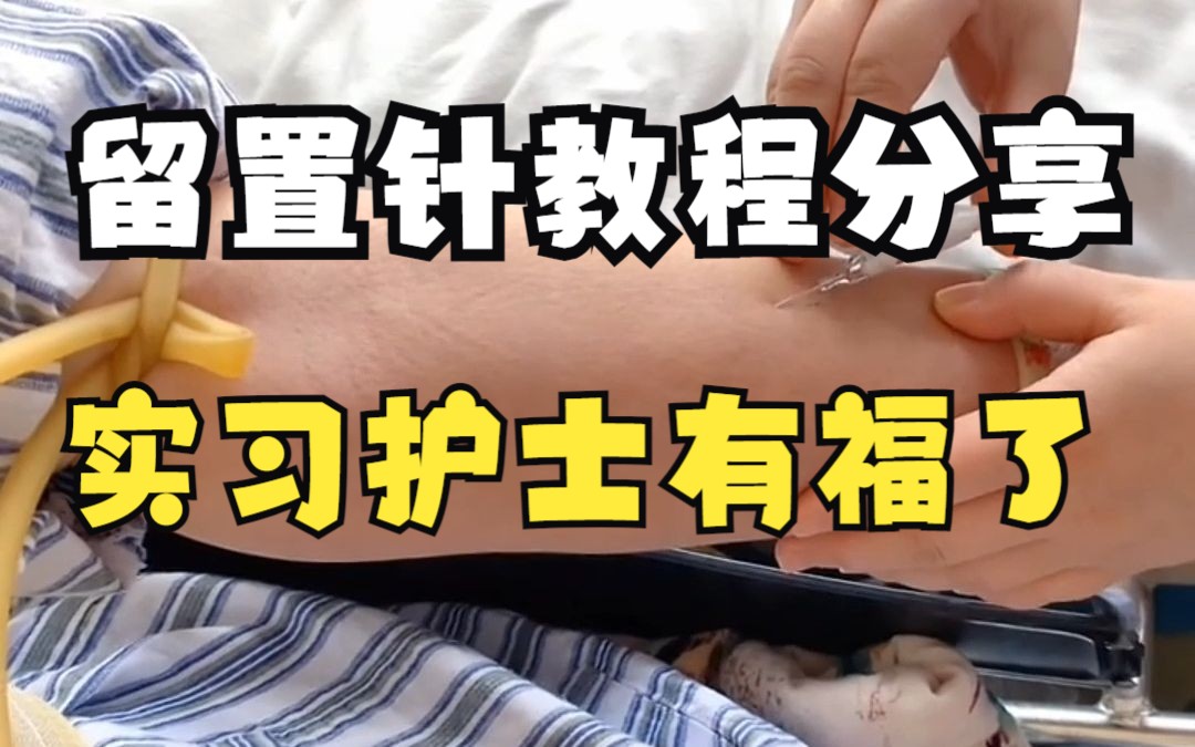留置针教程分享,实习护士们记得收藏