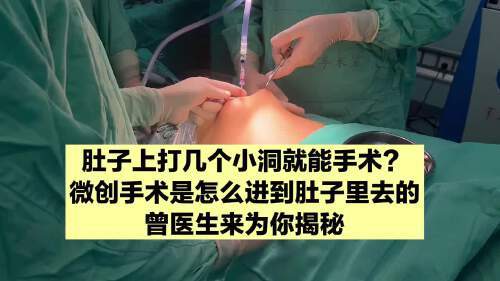 微创手术切口那么小,是怎么操作的?曾医生告诉你答案