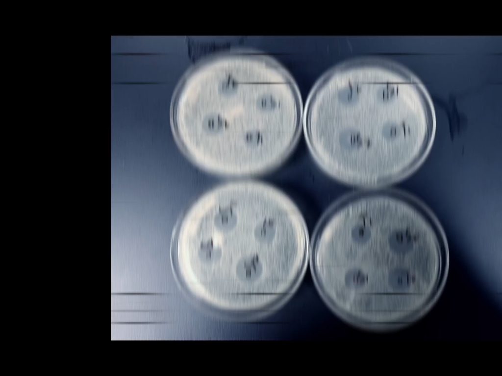 又是抗生素效价检测成功的一天,看这抑菌圈长得多好,金黄色葡萄球菌...