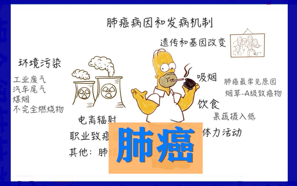 手绘漫画轻松记忆【肺癌】知识点,学霸的世界就是这么有趣