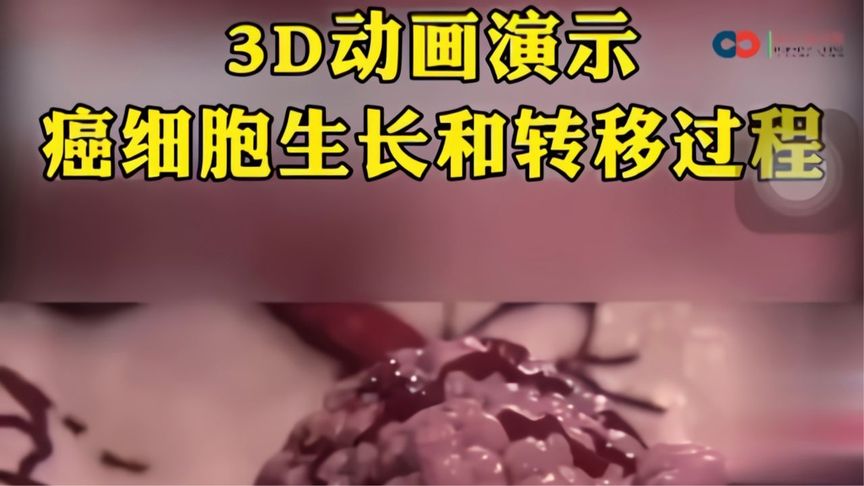 3D动画演示---癌细胞生长和转移的过程