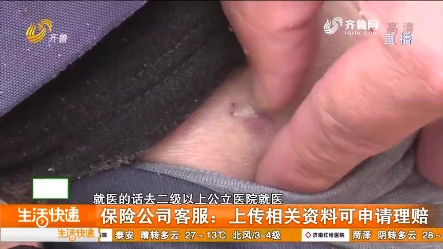 济南外卖员送餐上门,被屋内宠物狗咬伤,回拨客户电话惹一肚子气