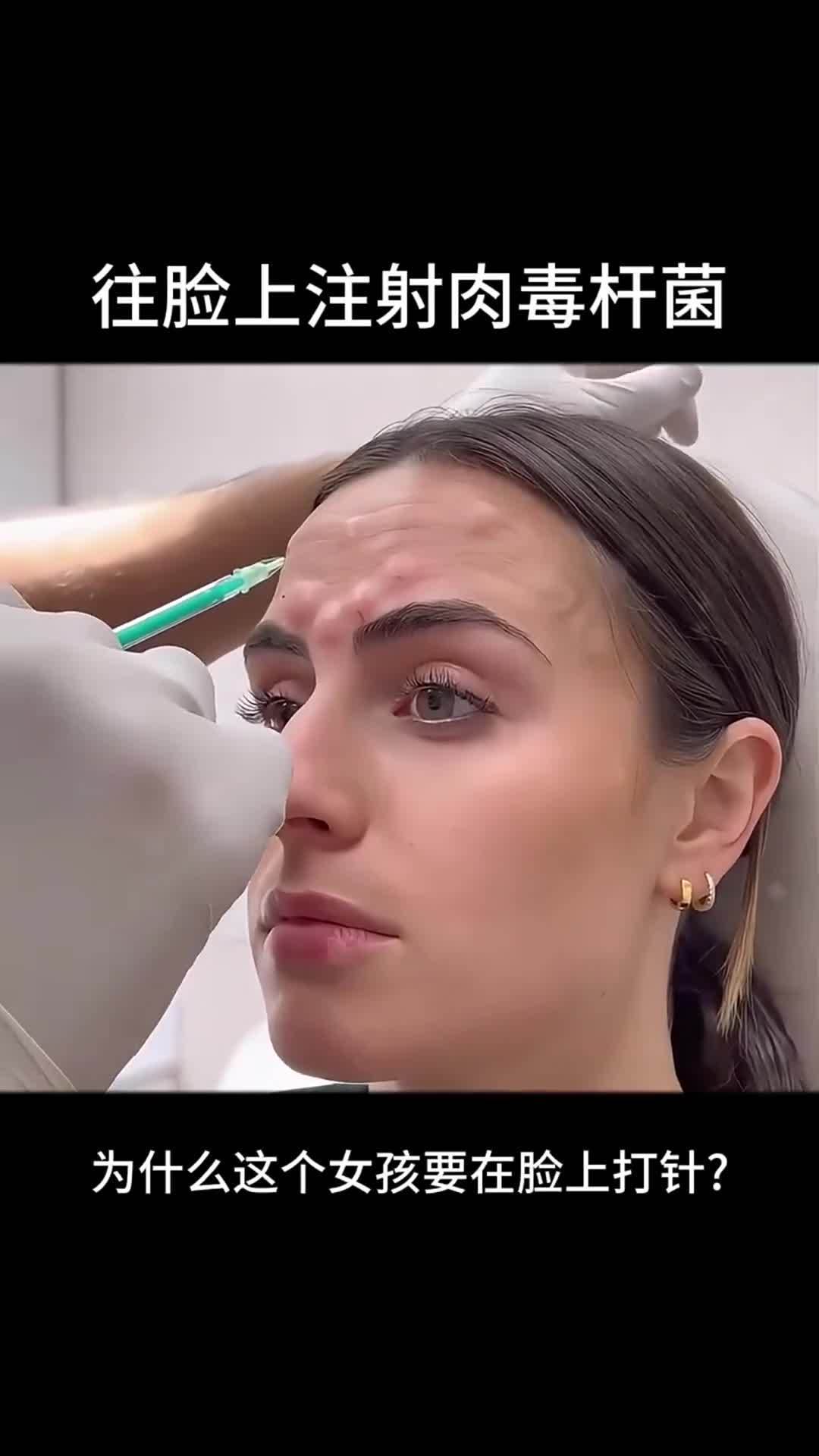 注射肉毒杆菌为何遭人批评