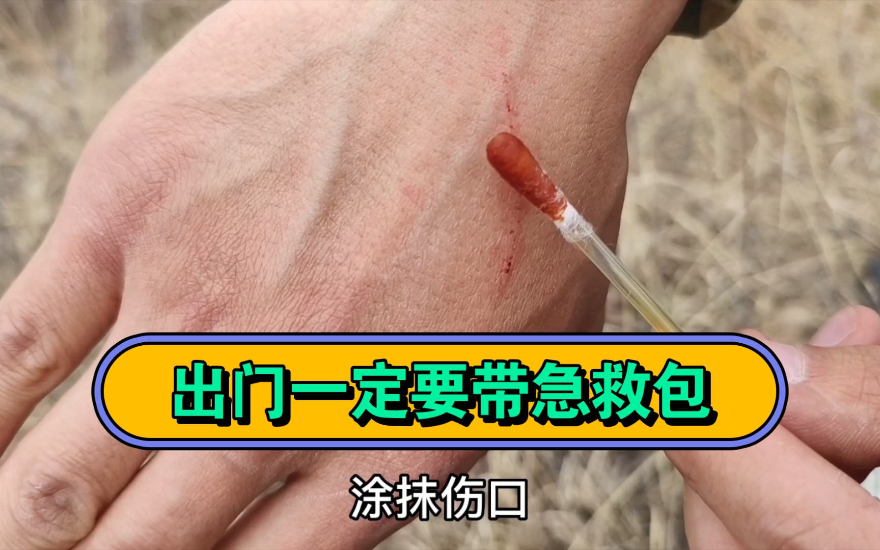 出门一定要带急救包 教大家正确使用碘伏棉签
