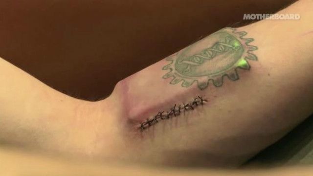 人体改造:他把一台微型计算机,植入手臂中