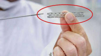 心脏支架是如何放进心脏的?3D动画演示全过程,看完后悔莫及