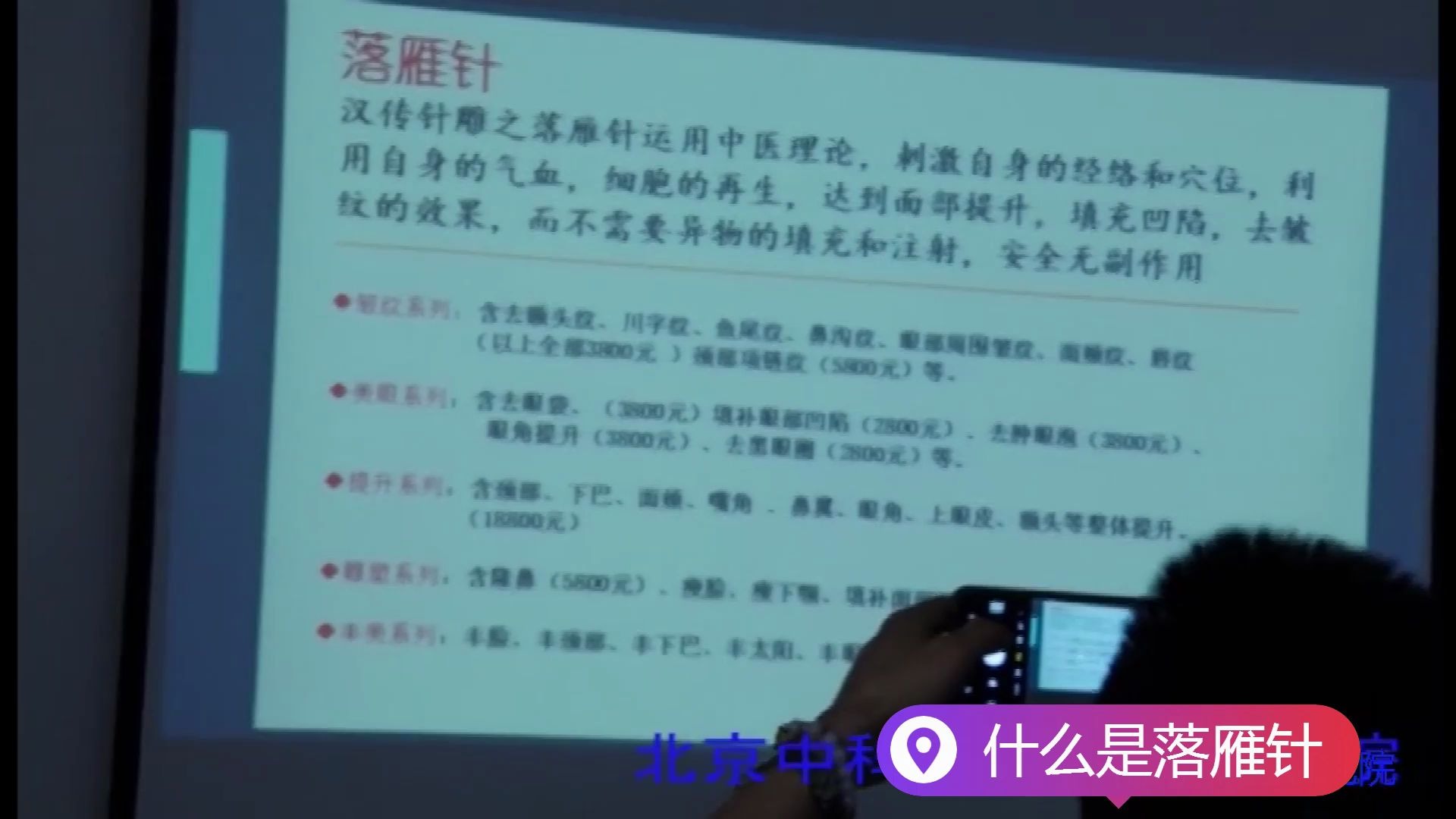 汉传针雕一针灸美容五套针法讲解